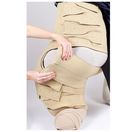 Medi Circaid Reduction Kit Lobe - SunMED Choice